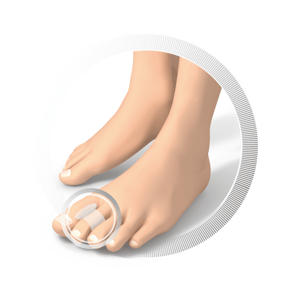 Indlæg & Aflastninger Tagged "Ligtorn" - FodProdukter.dk